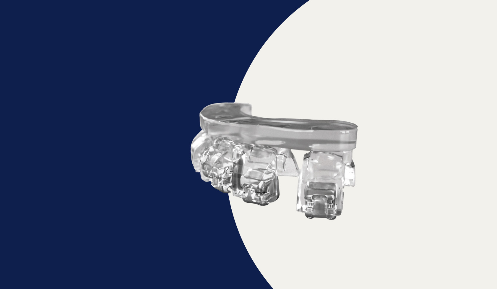 Ormco Digital Bonding - Un único portal para presentar casos