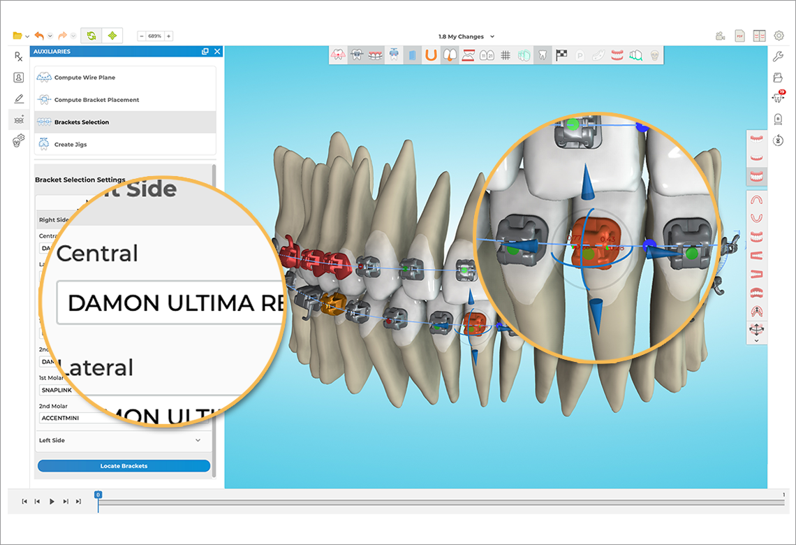 Ormco Digital Bonding - Un único portal para presentar casos