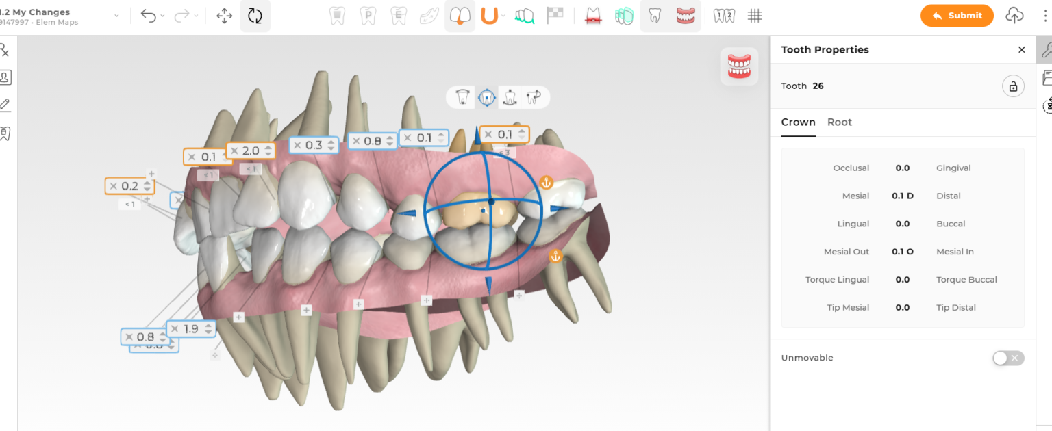 Spark™ Releases: actualizaciones nuevas de alineadores Spark